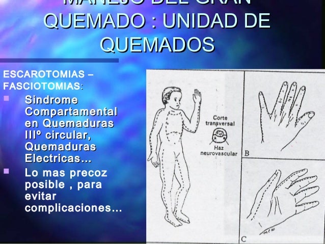 Manejo del-gran-quemado-dra.-lujan