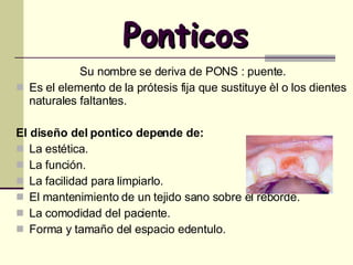 Manejo EstéTico De La RehabilitacióN Oral | PPT