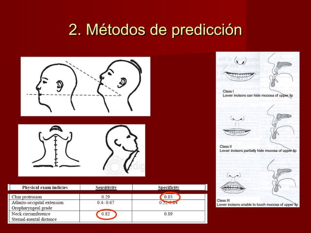Manejo Via Aerea Dificil | PPS | Lung and Respiratory Health | Diseases ...