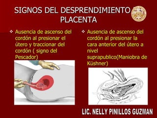Manejo Activo Alumbramiento 08 | PPT