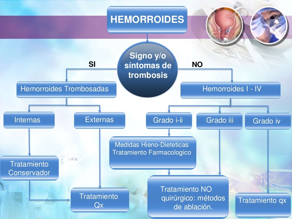 Manejo actual de la hemorroides
