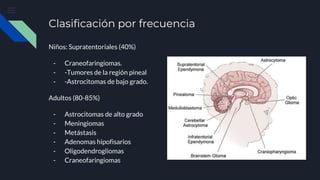 Manejo anestesico de tumores supratentoriales.pptx