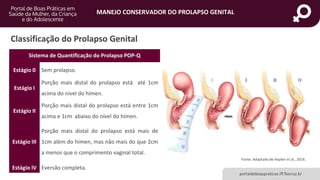 Manejo Conservador do Prolapso Genital | PPT