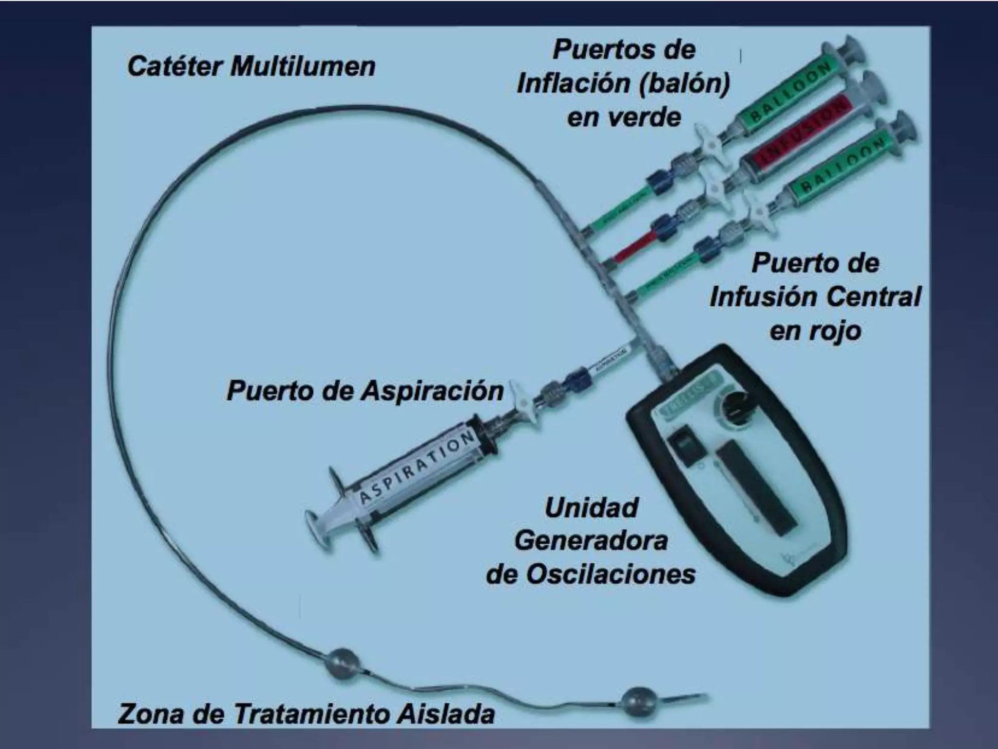 DEEP VEIN THROMBOSIS & CATHETER DIRECTED MECHANICAL THROMBECTOMY | PPTX
