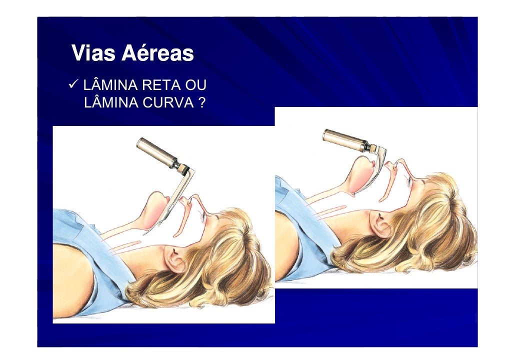 Manejo Da Via Aérea