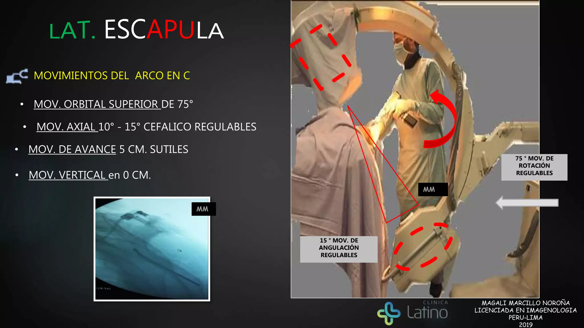 Manejo de arco en c en traumatologia | PPTX