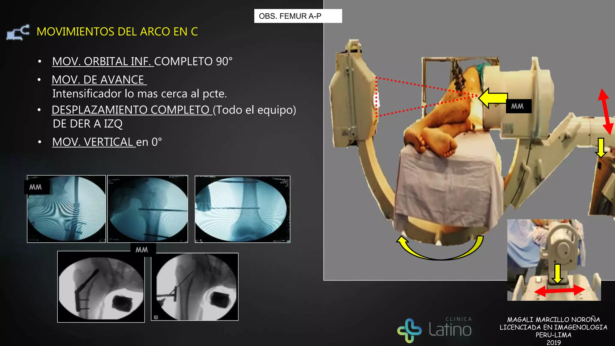 Manejo de arco en c en traumatologia | PPTX