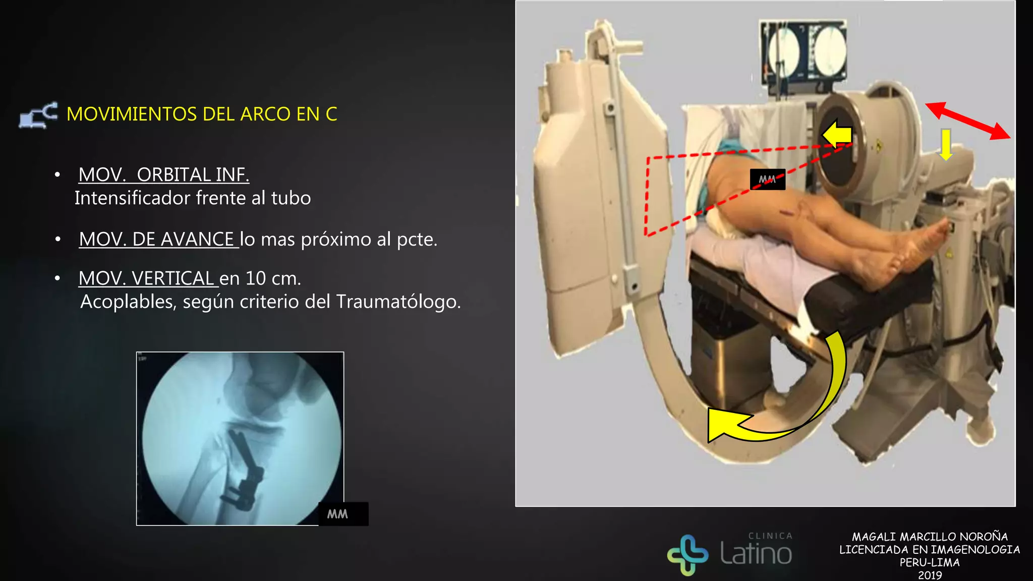 Manejo de arco en c en traumatologia | PPTX