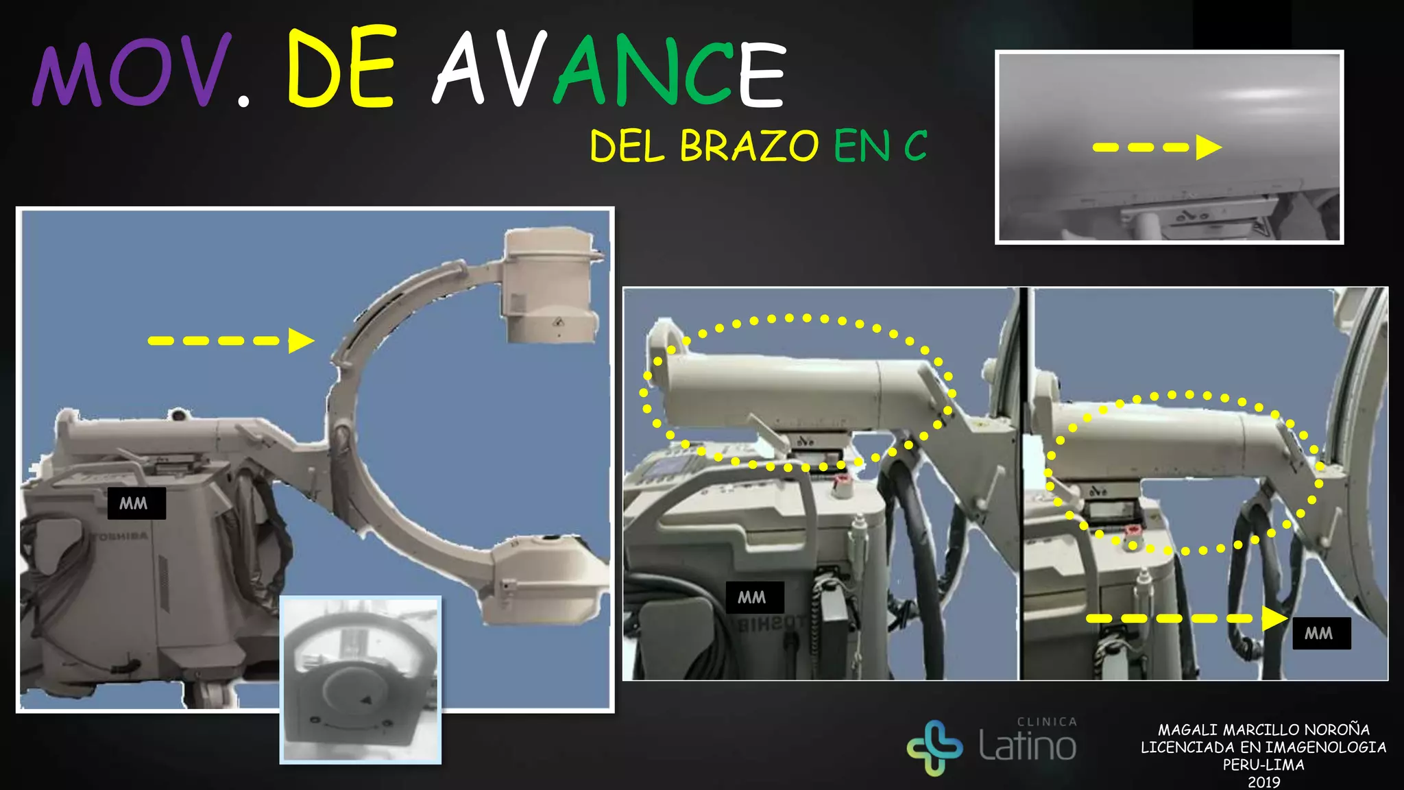 Manejo de arco en c en traumatologia | PPTX