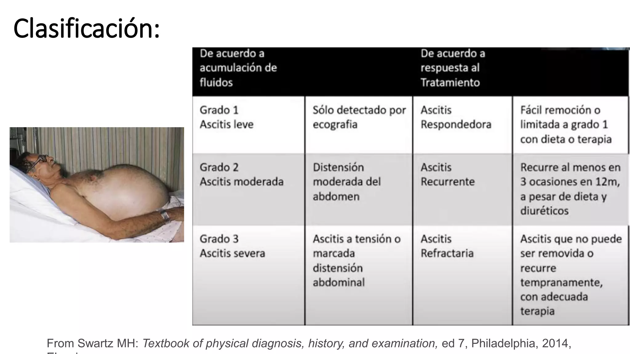 Manejo de Ascitis.pptx | Digestive Disorders | Diseases and Conditions