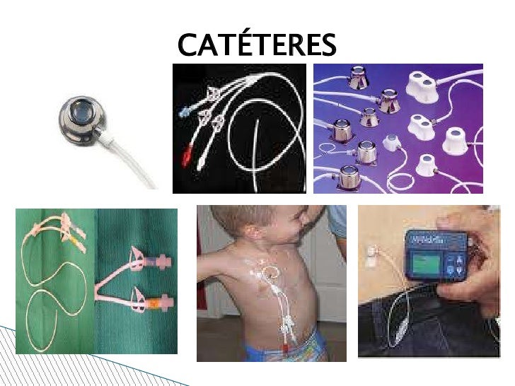 Manejo de cateteres