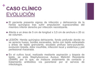 Manejo de heridas | PPTX