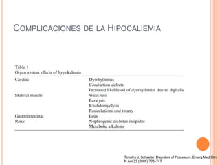 Manejo de la hiponatremia e hipocaliemia en el | PPTX