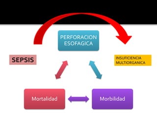 Manejo de la perforacion esofagica | PPTX