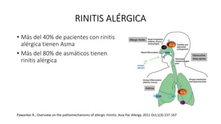 Manejo de la rinitis | PPTX