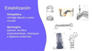 Manejo de las Fracturas.pptx