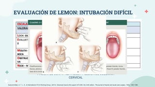 Manejo de la vía aérea_Medicina de urgencias_Equipo1.pptx