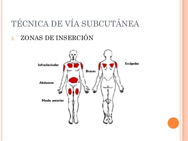 Manejo de la vía sucutánea.
