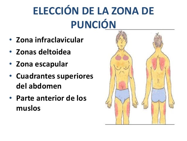 Manejo de la vía subcutánea en atención primaria