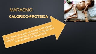 MANEJO DEL DESNUTRIDO AGUDO SEVERO [Autoguardado].pptx