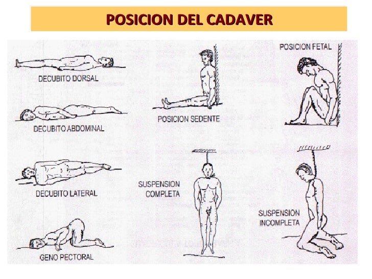 Manejo del lugar de los hechos