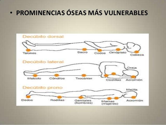 ASISTENCIA DEL PACIENTE ENFERMERIA