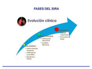 Manejo del SIRA en el paciente en estado crítico | PDF