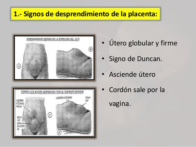 Manejo del trabajo del parto