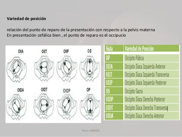 Manejo del trabajo del parto
