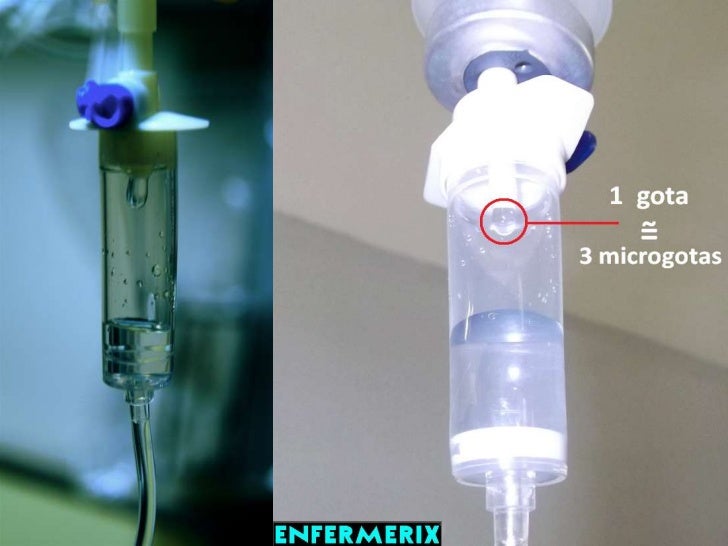 Nursing: FACTOR GOTEO