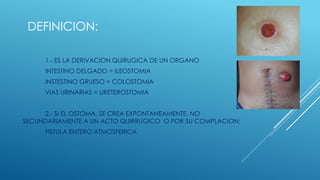 Manejo de ostomías – fistulas entero cutaneas.pptx