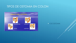 Manejo de ostomías – fistulas entero cutaneas.pptx