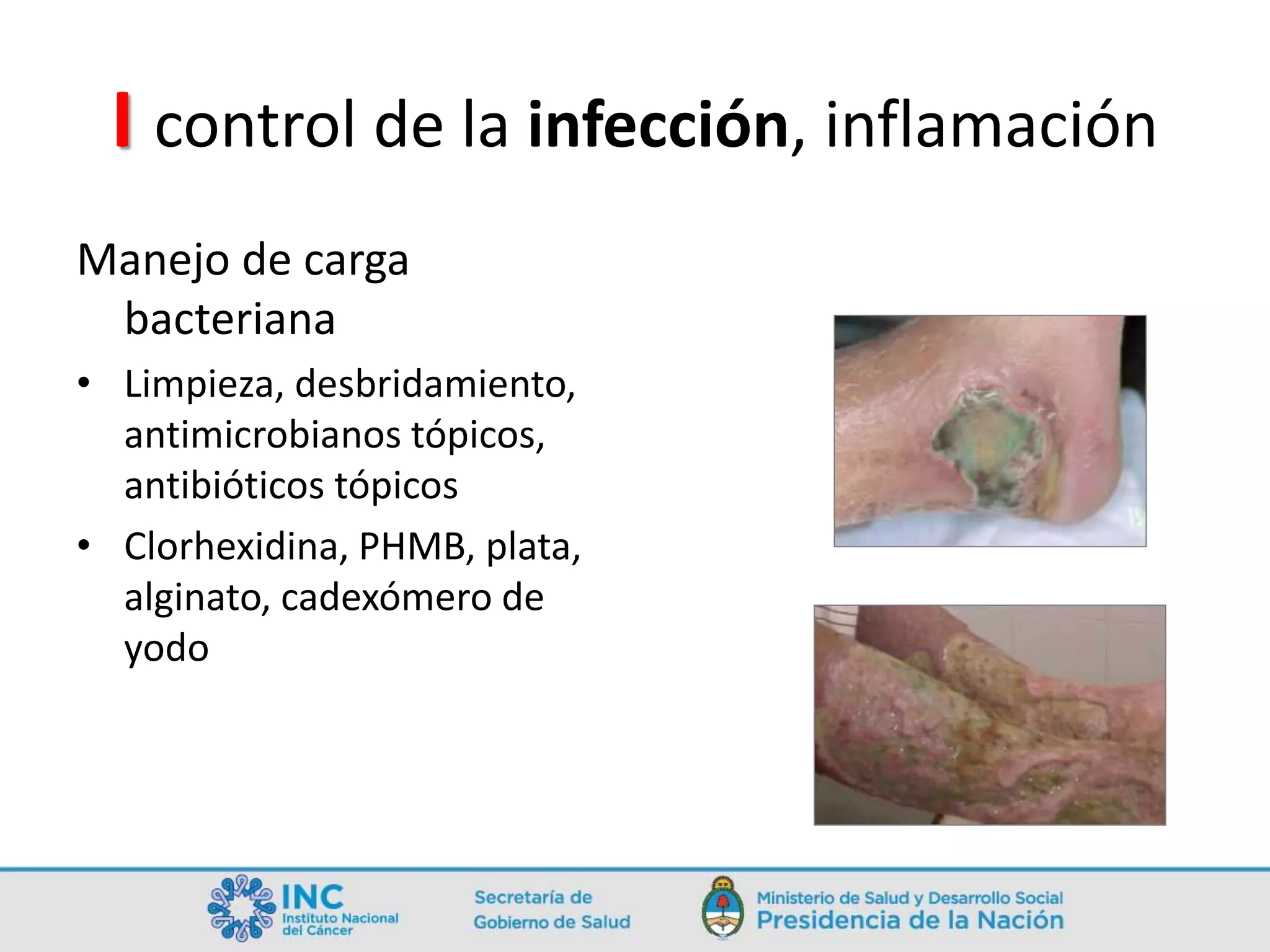 manejo_de_ulceras_por_presion_en_cuidados_paliativos.pptx