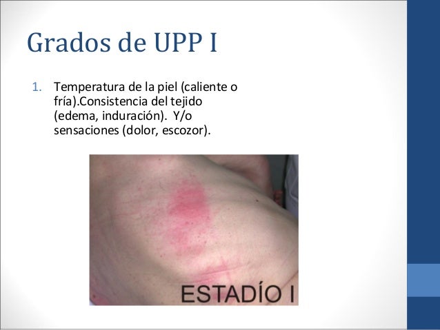 Manejo de UPP jonathan