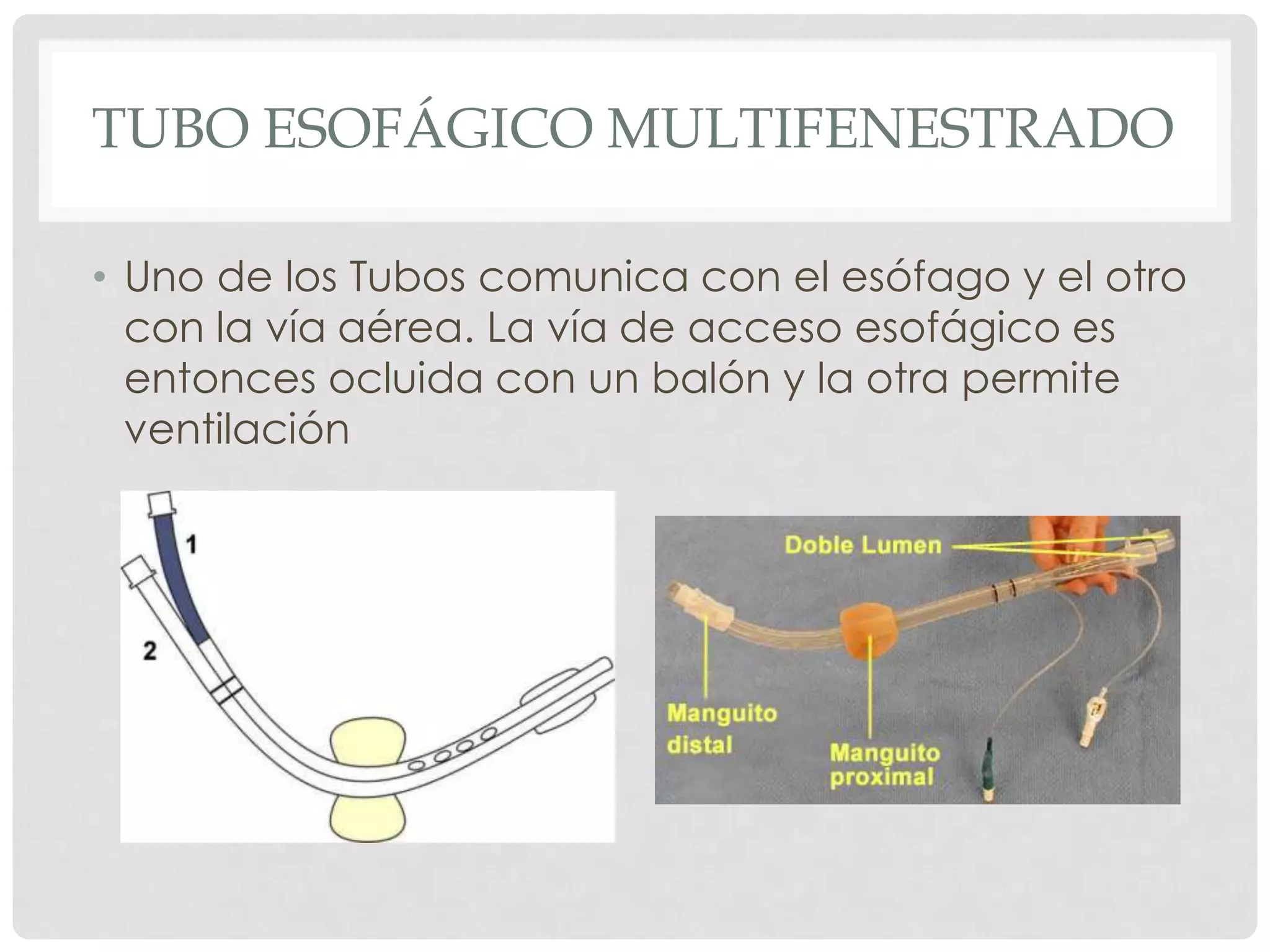 Manejo de vía aérea y ventilacion (atls) | PPTX