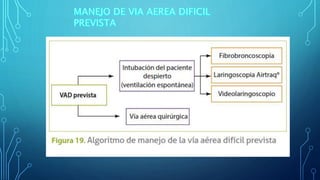 MANEJO DE VIA AEREA Y RCP.pptx