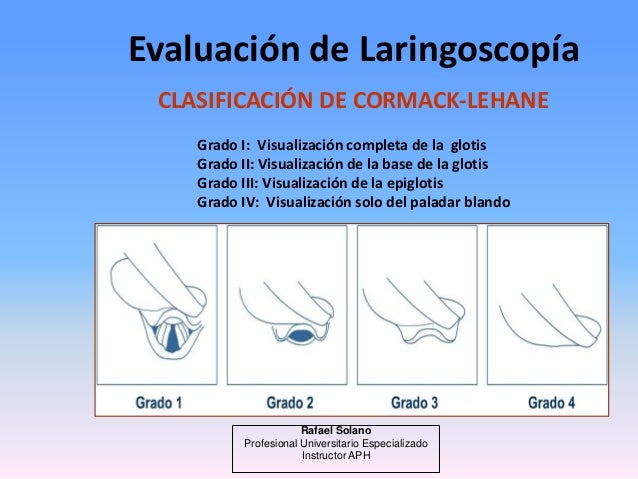 Manejo de vias aereas altas