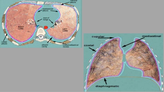 Manejo espacio pleural