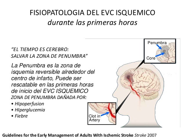 Manejo evc isquemico