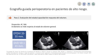Manejo hemodinámico en el paciente crítico 4.pptx