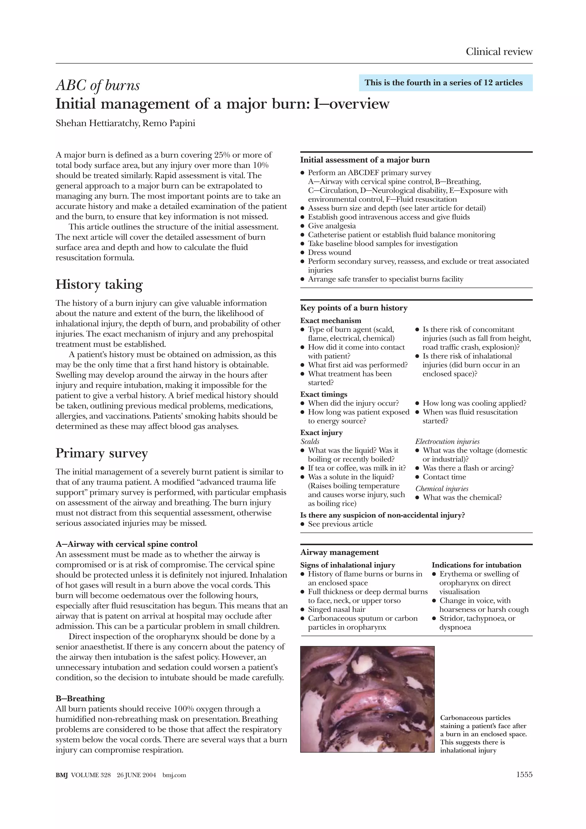 Manejo inicial gran quemado i | PDF