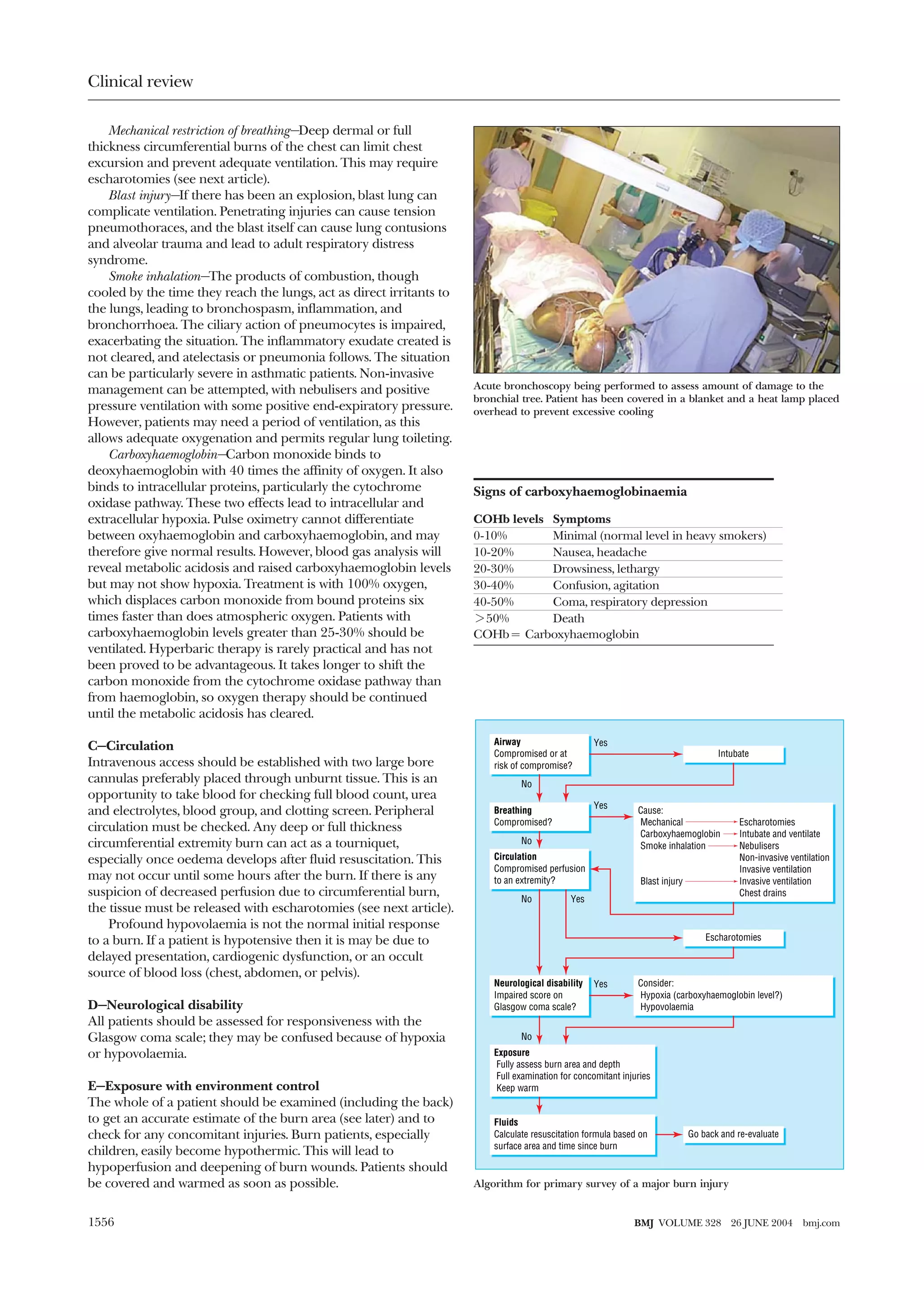 Manejo inicial gran quemado i | PDF