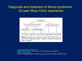 MANEJO LAPAROSCÓPICO DEL SINDROME DE MIRIZZI CP-IHPBA | PDF