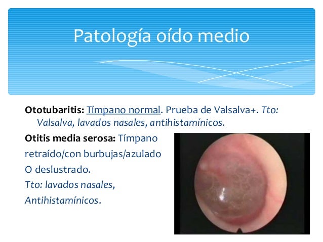 Manejo patología frecuente en orl