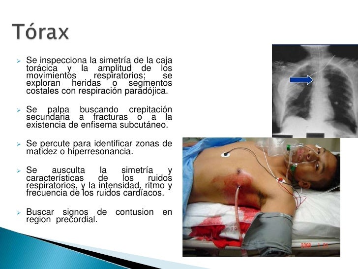 Manejo del paciente politraumatizado