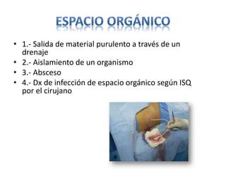 Infección, manejo quirúrgico. | PPTX