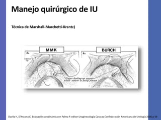 Manejo Quirúrgico del Suelo Pélvico | PPTX