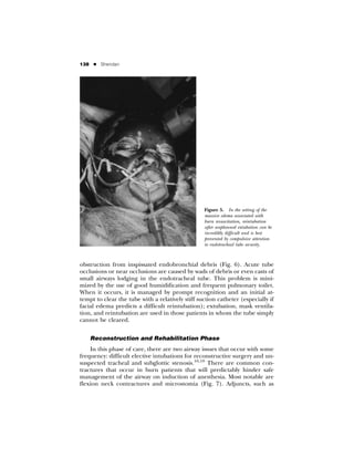 Manejo via aerea | PDF