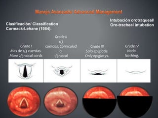 Manejo via aerea / Airway Management | PPTX