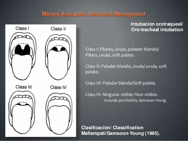 Manejo via aerea / Airway Management